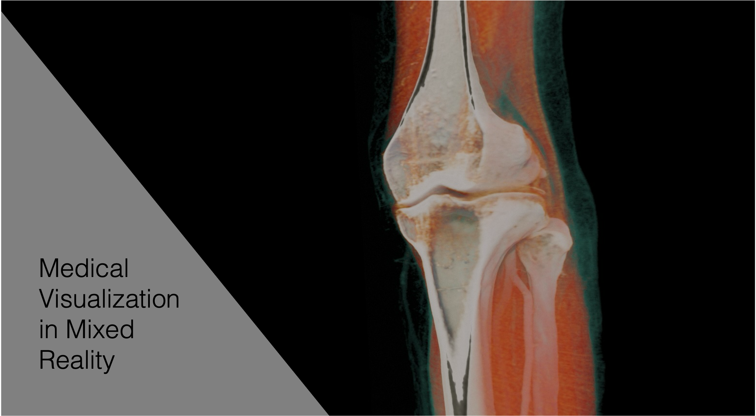 Medical Visualization in Mixed Reality | HEX Lab