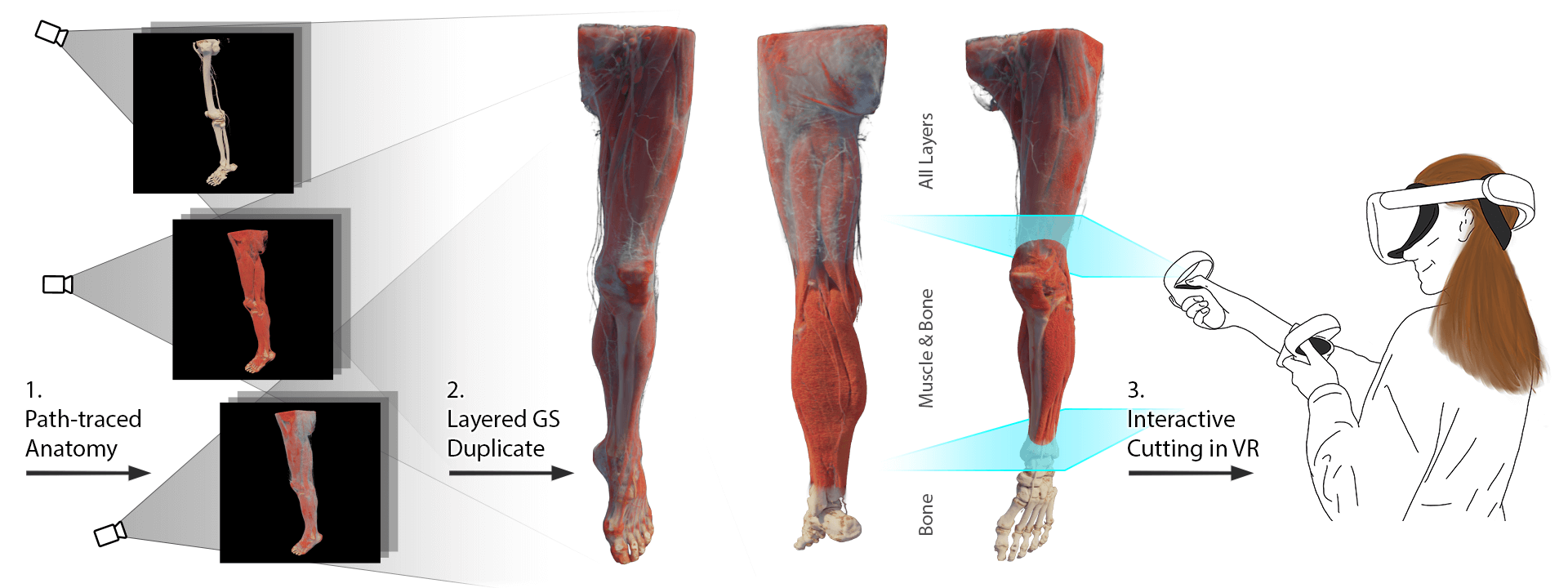 Multi-Layer Gaussian Splatting for Immersive Anatomy Visualization | HEX Lab
